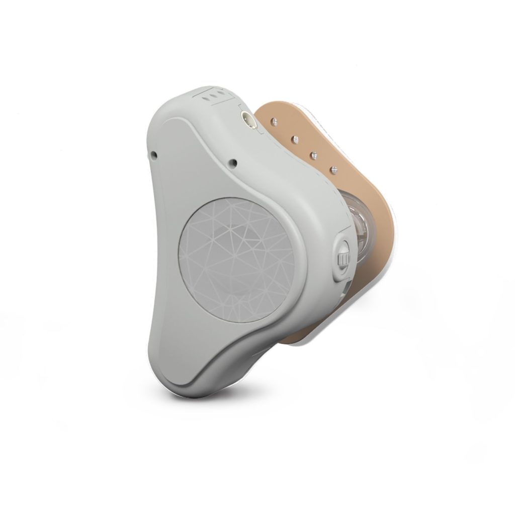 MED-EL USA receives FDA clearance for ADHEAR, a revolutionary non ...