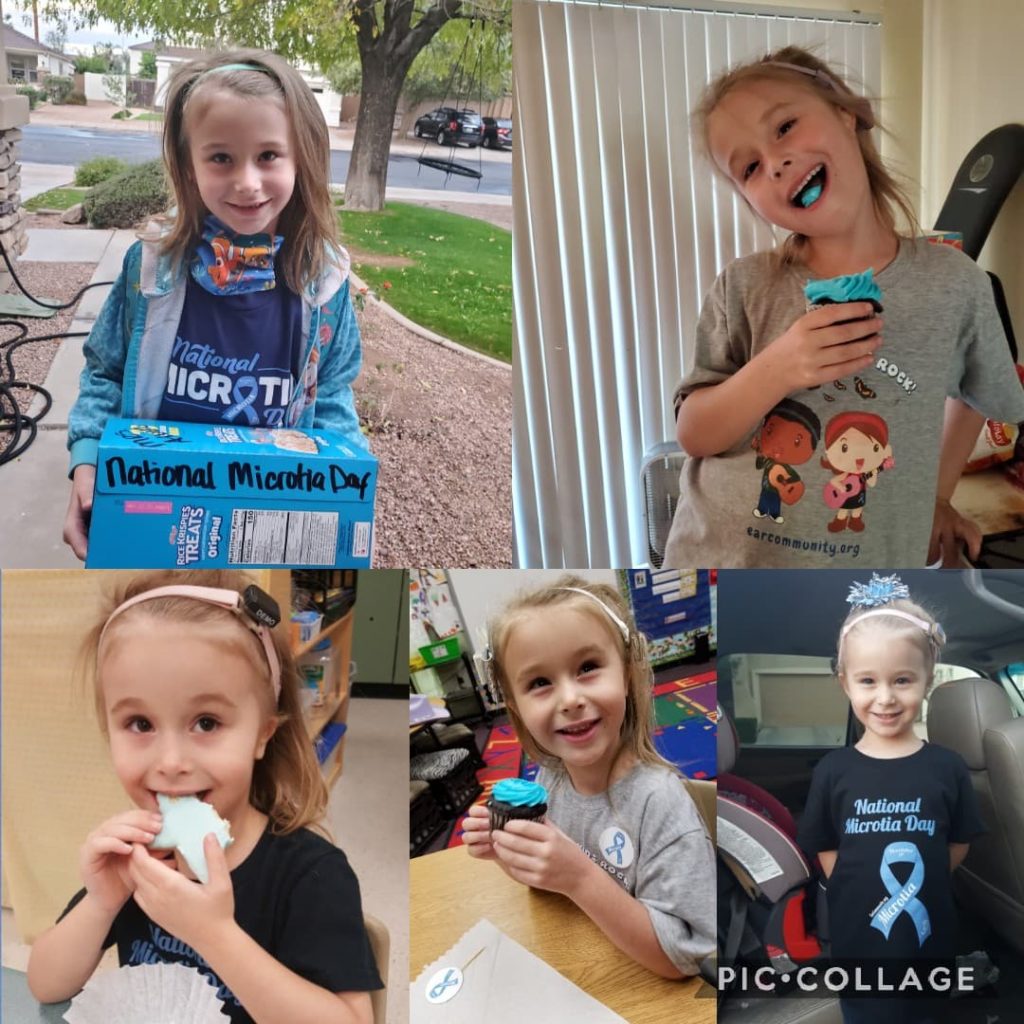 Microtia and Atresia Awareness Day – November 9th, 2020 | Ear Community