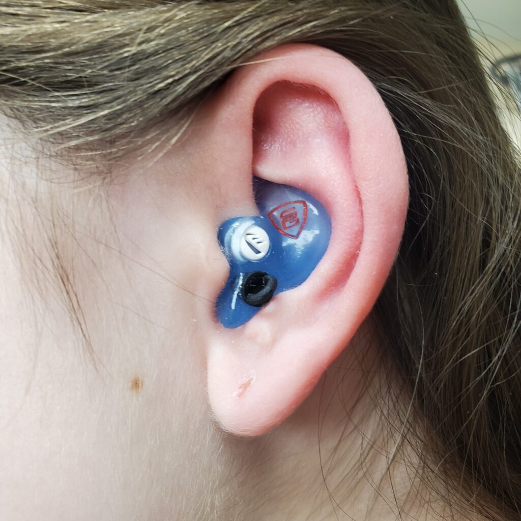 Microtia & Atresia Accessories | Ear Community